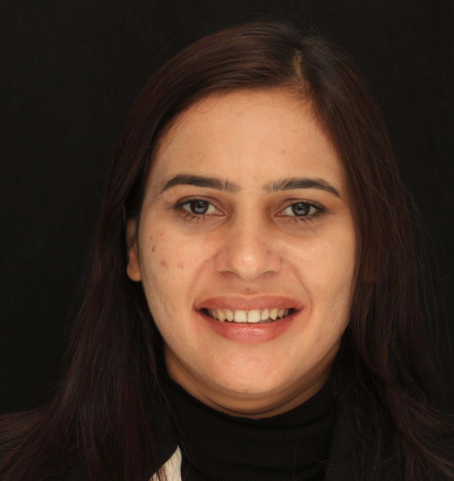 Cleaning and Polishing